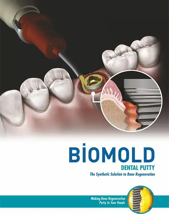 Biomold Dental Putty - Medical Entrepreneurs
